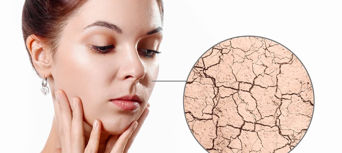 Pelle e sole, come rimediare ai danni - Vivocin